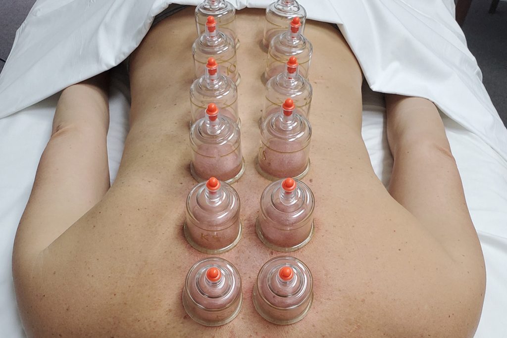 The 5 Pillars of Chinese Medicine … Pillar 3 – Body Work - Acupuncture ...